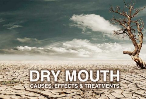 Dry Mouth Xerostomia Causes, Effects and Treatments - McOmie Dentistry ...